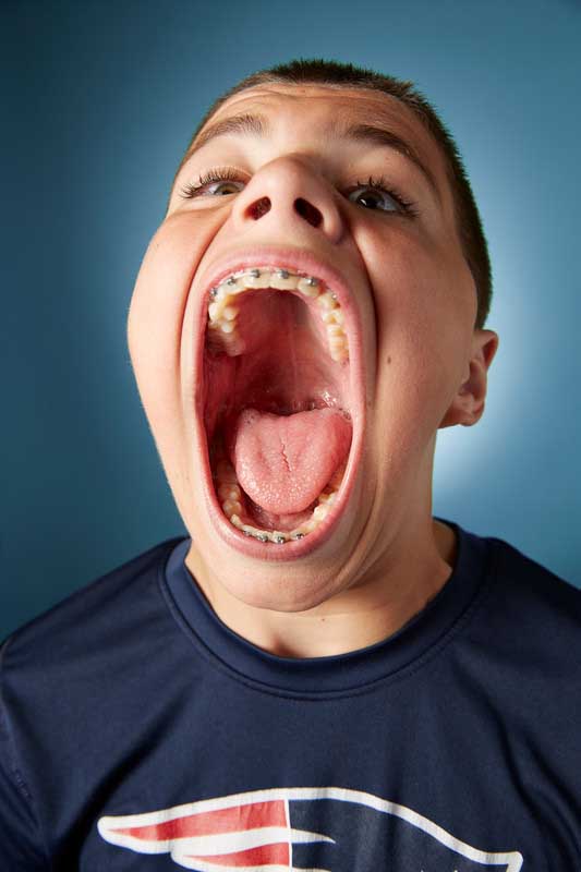 USA teenager has the biggest mouth in the world! | Guinness World Records