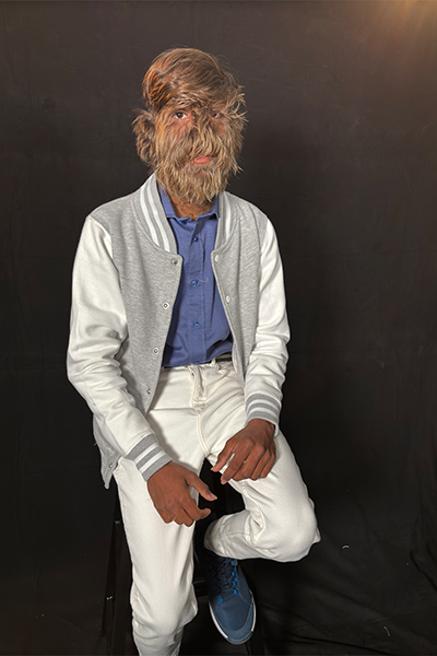 This teen has the world’s HAIRIEST face | Guinness World Records